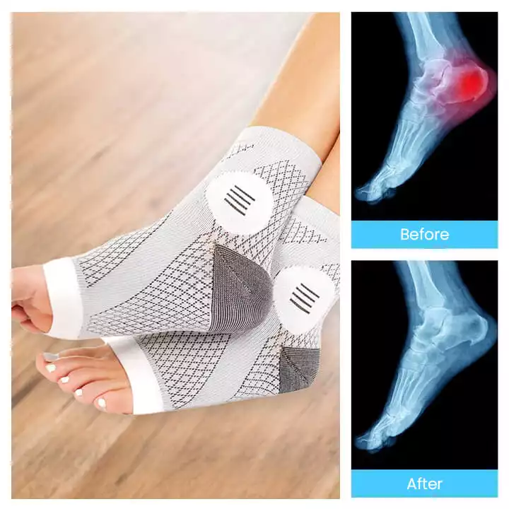 Neuro Compression Socks™️ (Limited Time Discount 🔥 Last Day）