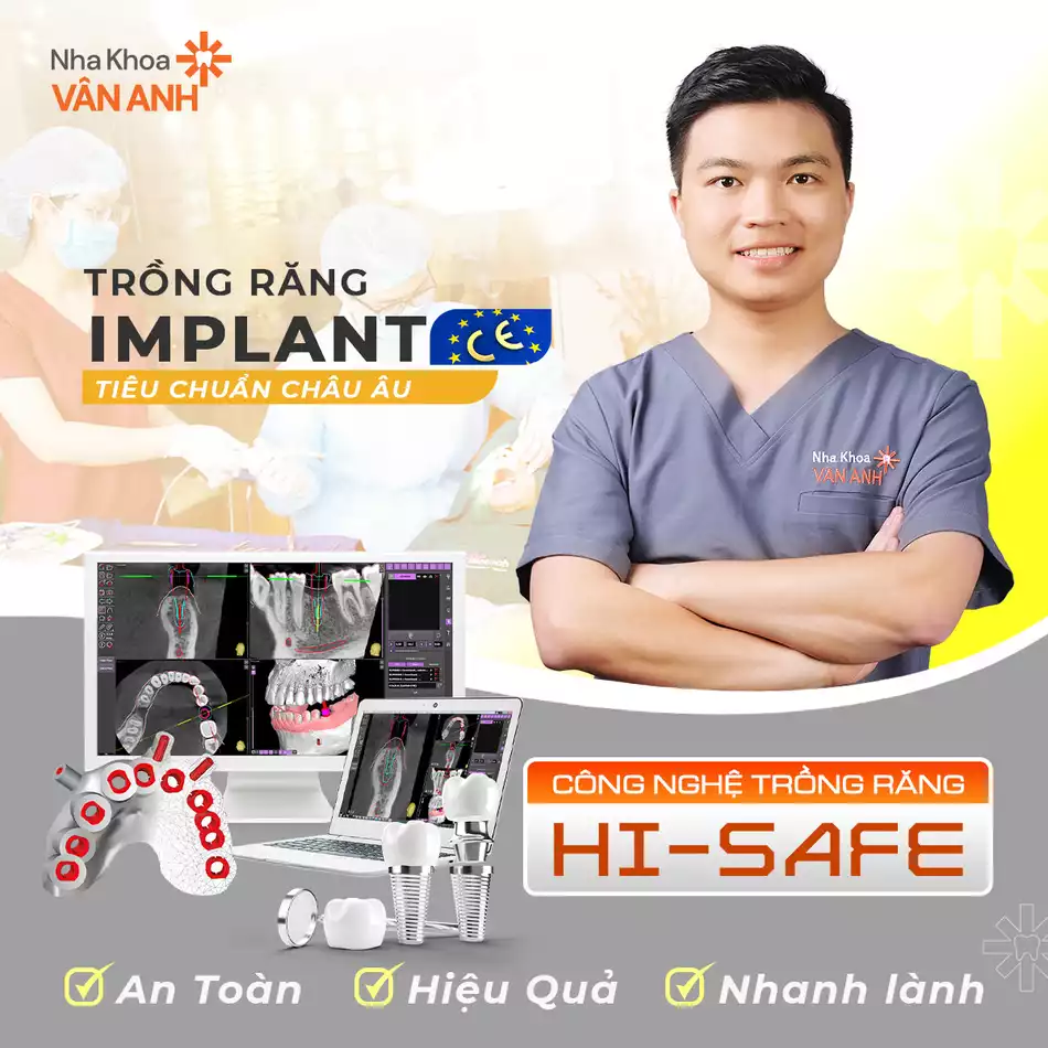 Trồng răng implant